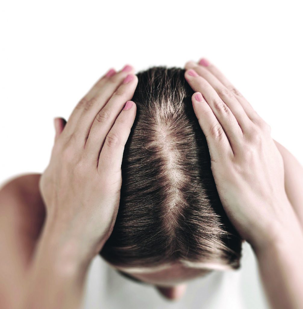 Alopecia sau căderea părului: cauze, tratamente | Jurnalul de Estetica
